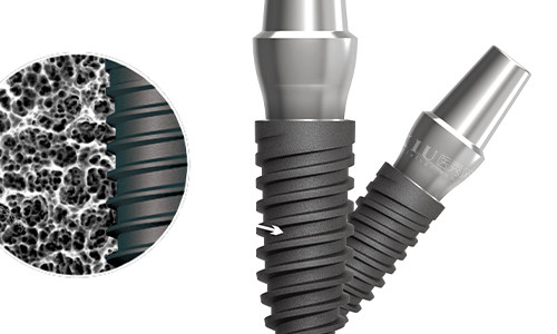 种植牙种植体十大品牌大公开，总有一款适合你-医秀网